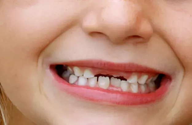 My Two Front Teeth | Music Feature | Seven Days | Vermont's Independent ...